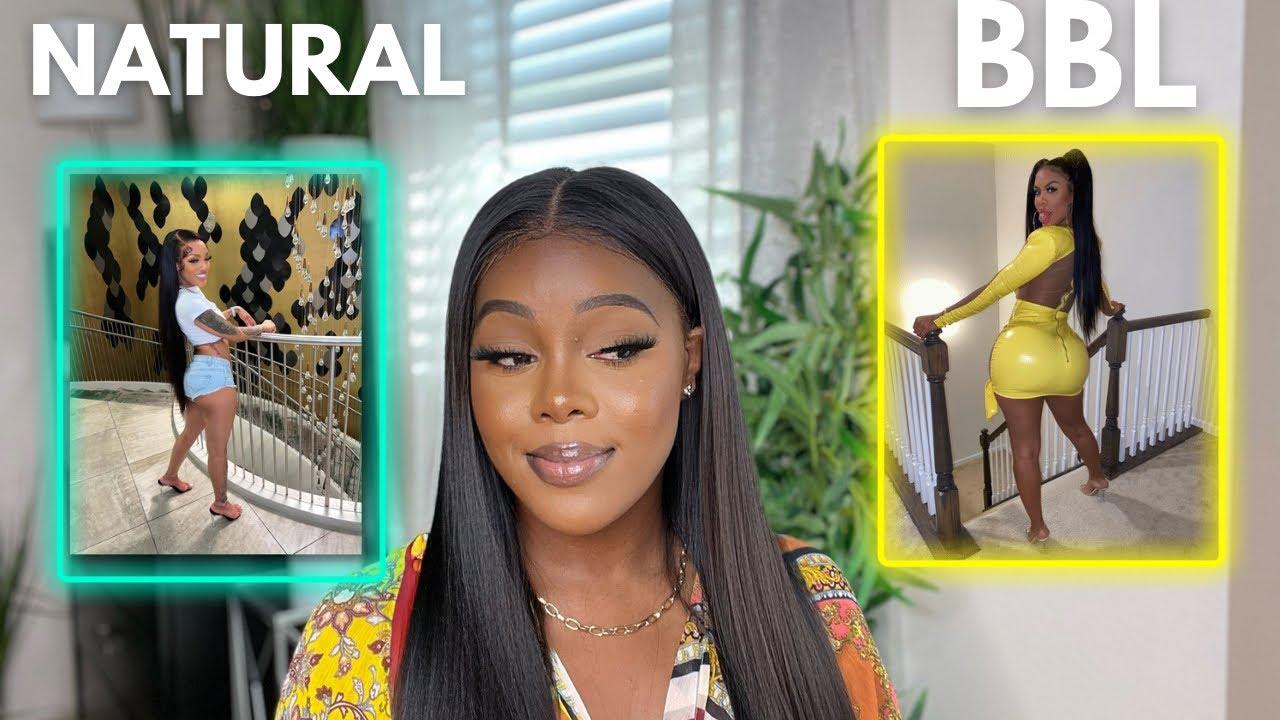 BBL vs Natural Body: Which Is Better? - Konnect
